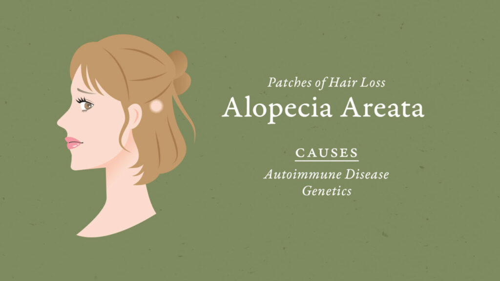 Hair Loss: Causes and Types - Simply Organics