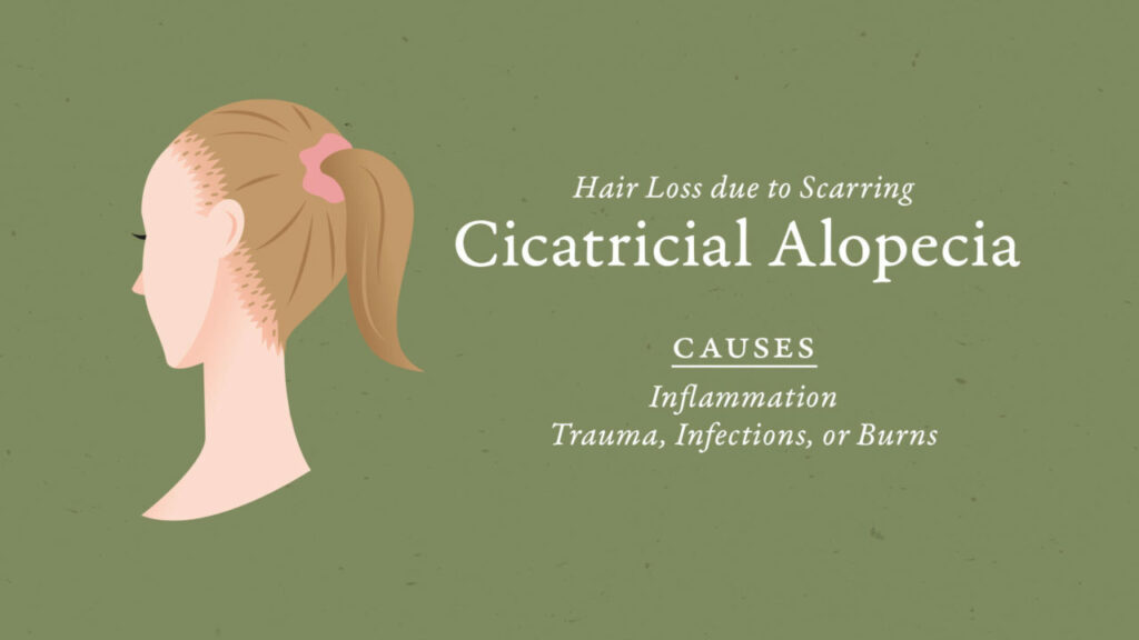 Hair Loss: Causes and Types - Simply Organics